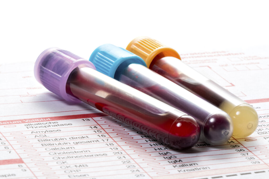 Robin’s Comprehensive Blood Panel | Natural Hormone Solution Robin’s Comprehensive Blood Panel | Natural Hormone Solution