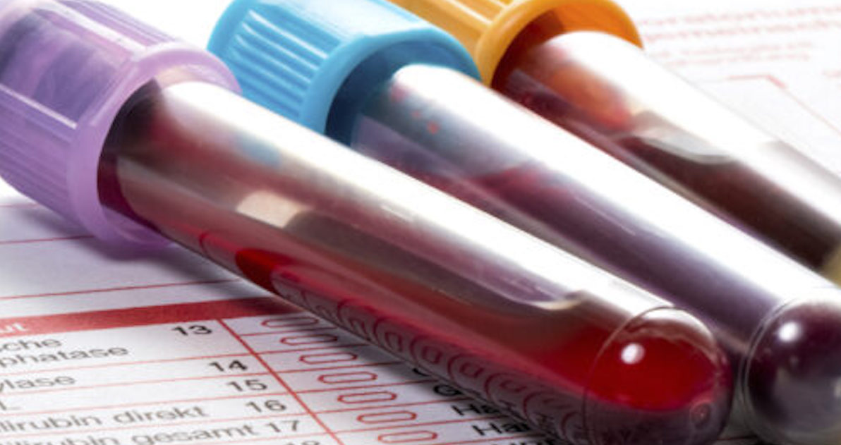 Robin's Comprehensive Blood Panel